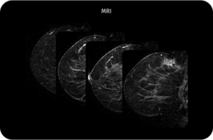 Technology – SimBioSys