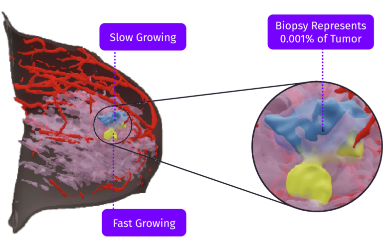SimBioSys – Redefine precision medicine