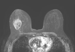 Technology – SimBioSys