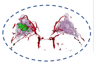 Technology – SimBioSys